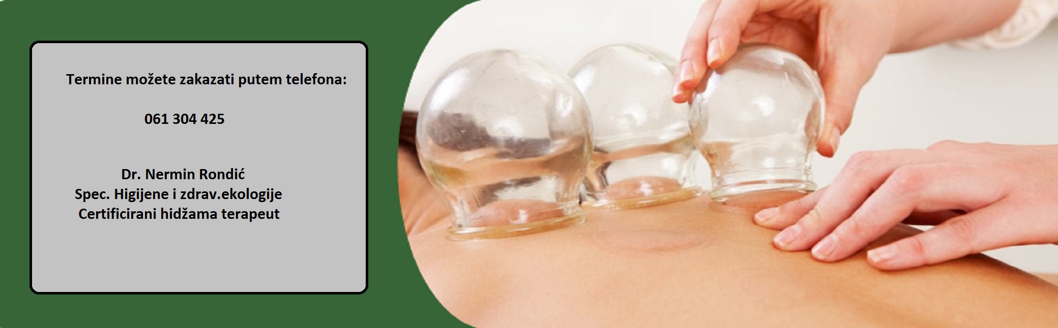 ŠTA JE HIDŽAMA - CUPPING THERAPY? - Zenicablog